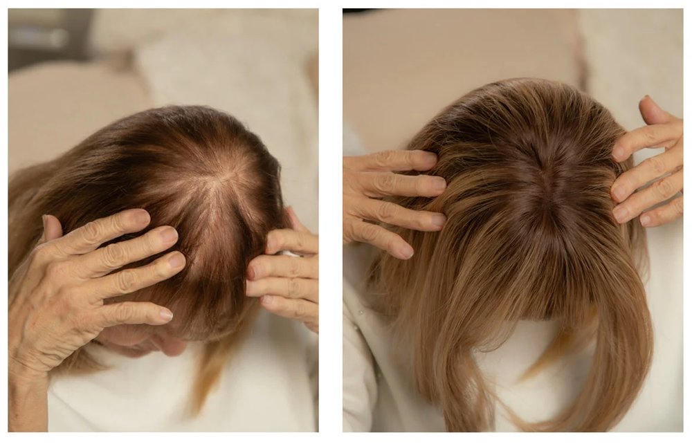 How to Style and Wear a Hair Topper to Conceal Hair Loss for Your Customer？